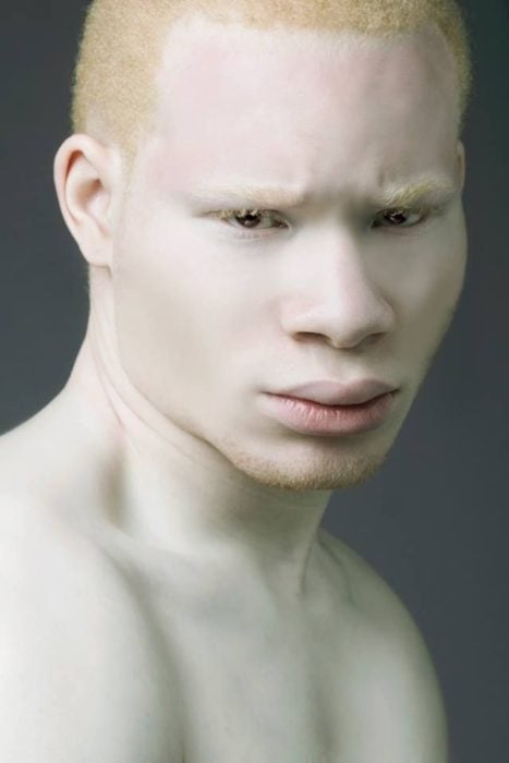 23 Fotos que muestran la belleza de personas con albinismo