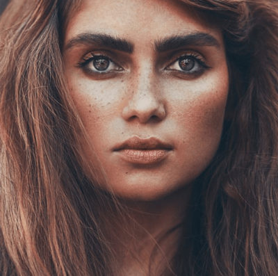 20 personas que demuestran que las pecas son hermosas