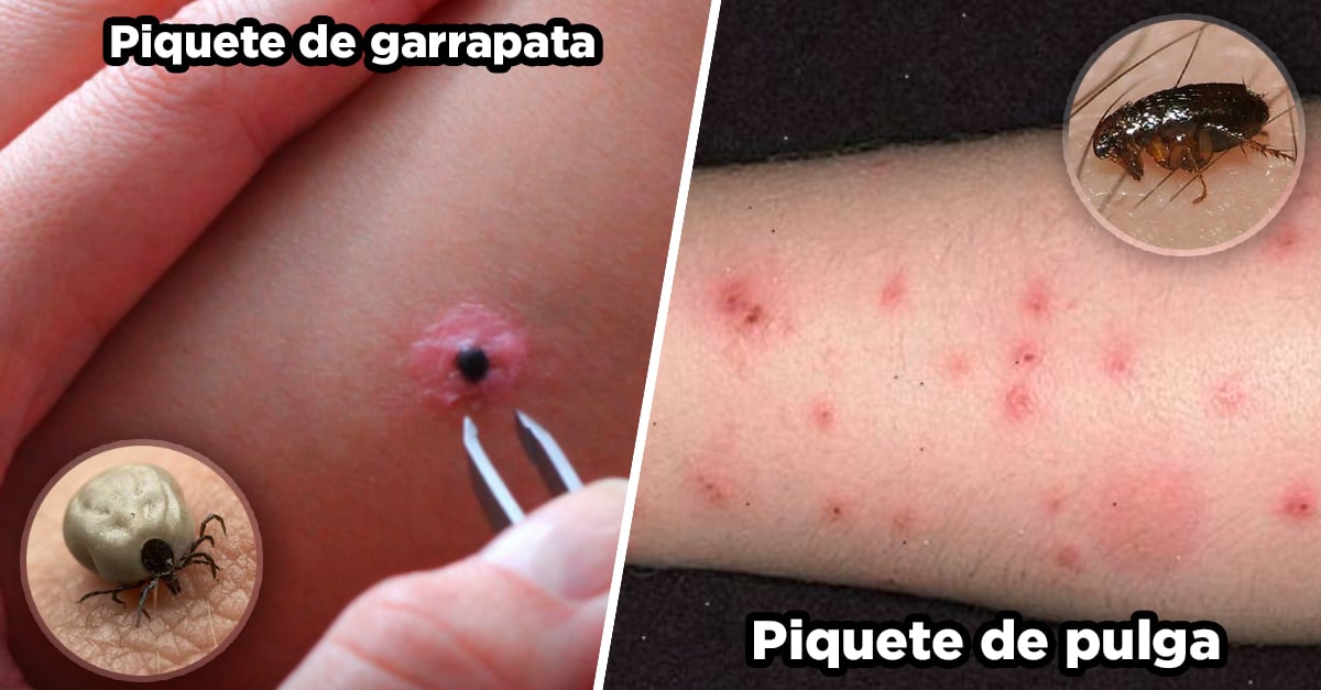 Estos son los piquetes de insecto más comunes que hay