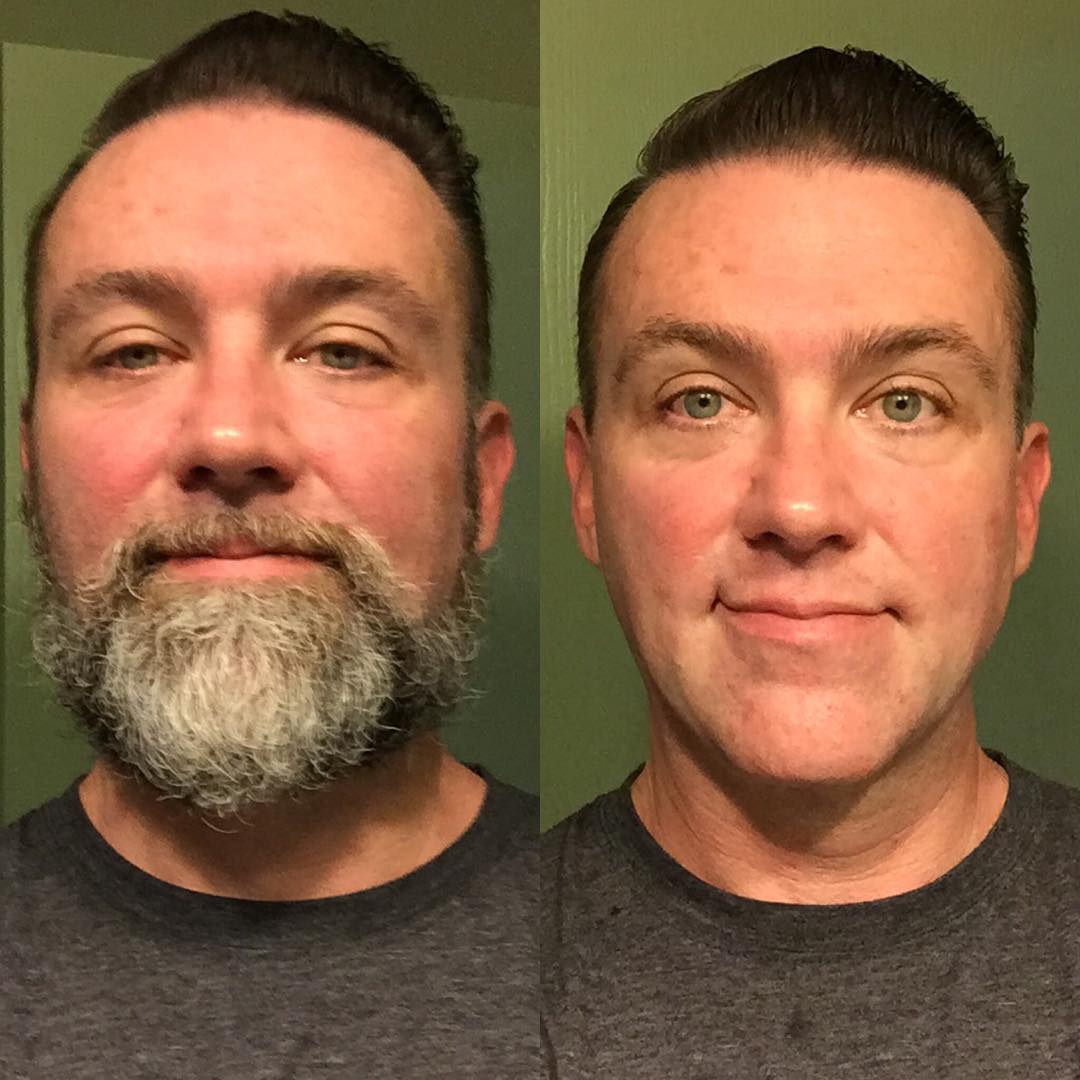 13 Antes y después de la barba te dejarán con la boca abierta