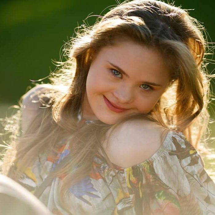 Adolescente con Down persigue su sueño y triunfa como modelo